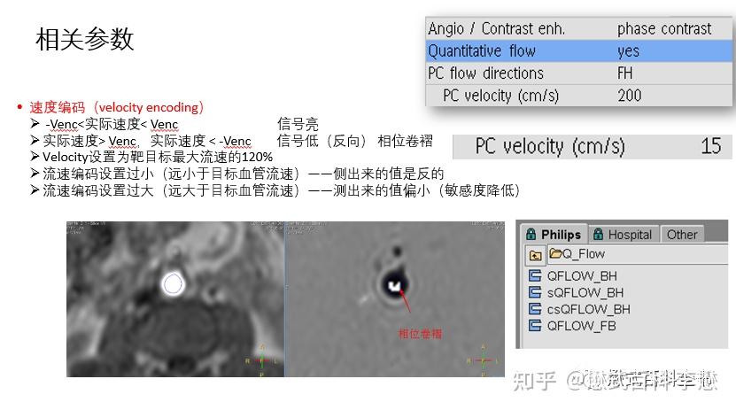4D-Flow扫描数据采集：序列及参数 - 知乎