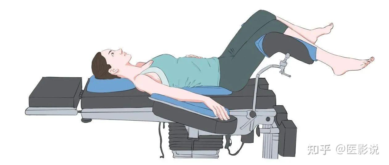 专家共识 | EULIS 与 IAU联合专家对输尿管镜碎石术共识的解读 - 知乎