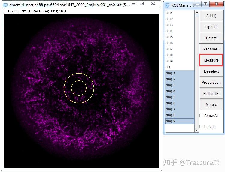 ImageJ实用技巧——径向荧光平均值检测(定量分析篇) - 知乎