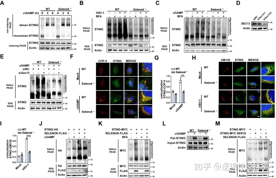 PLoS Pathog︱山东大学贾木天/赵伟团队揭示硒蛋白调控STING激活新机制 - 知乎
