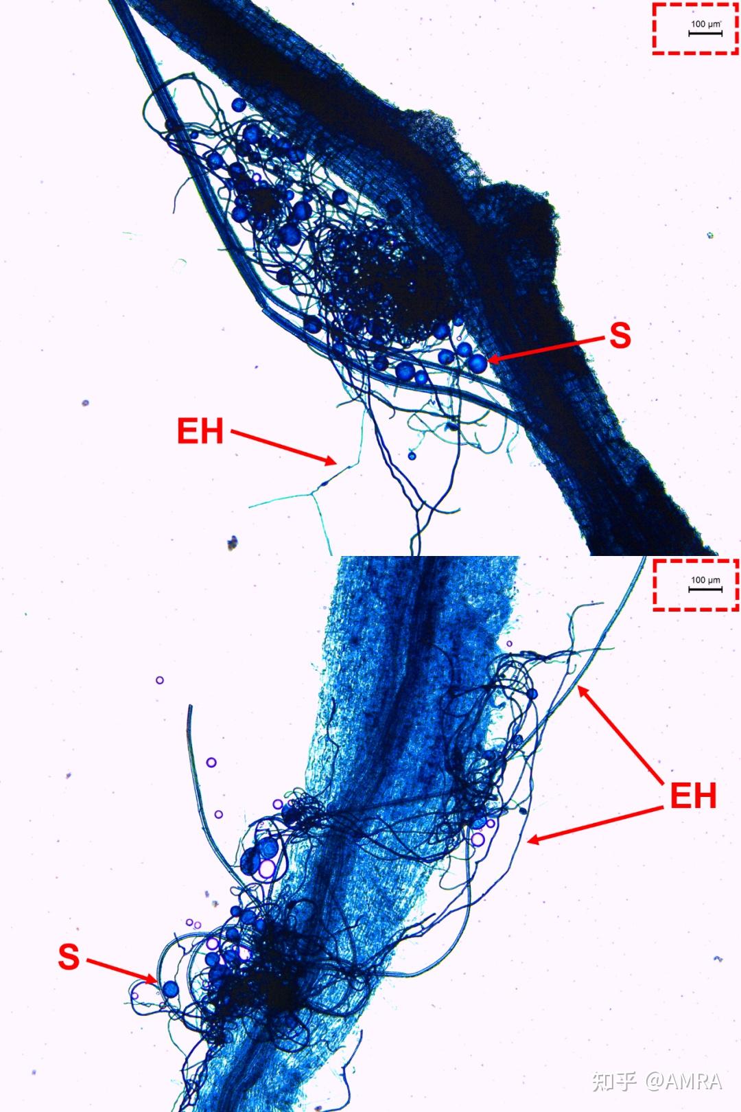 丛枝菌根真菌（AMF）染色图和详细方法 - 知乎