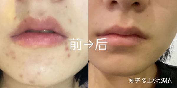 坚持吃什么能让皮肤变好？ 知乎