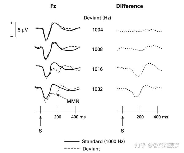 基础视听觉ERP成分 - 知乎