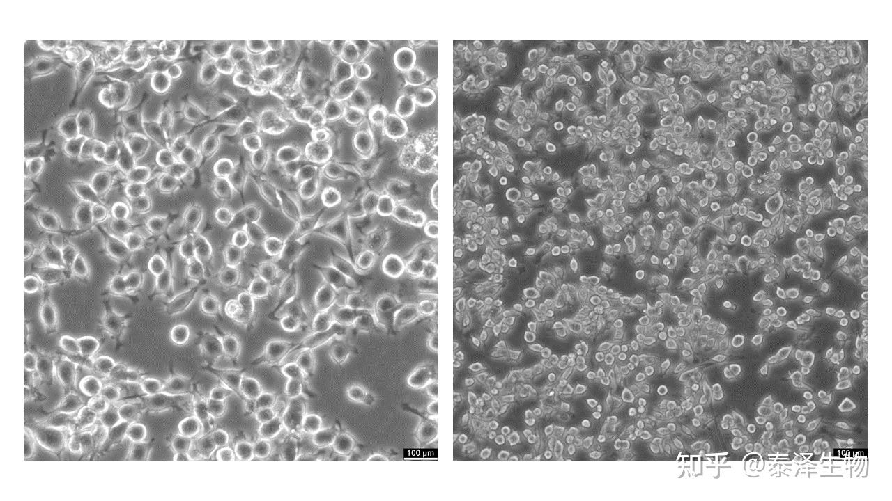 【细胞小讲堂】BV2—小鼠小胶质细胞的全面剖析,了解 BV2 小胶质细胞在神经科学研究中的重要性 [特点、应用、培养方法与研究进展] - 知乎