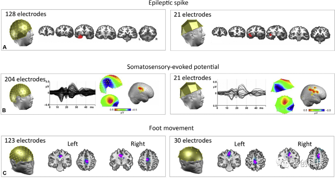 高分辨率EEG的空间分析 - 知乎