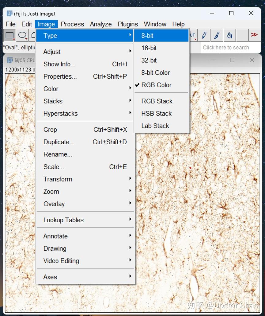Image J 统计免疫组化片子阳性信号的平均光密度值教程 - 知乎