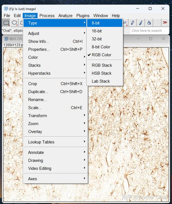 Image J 统计免疫组化片子阳性信号的平均光密度值教程 - 知乎