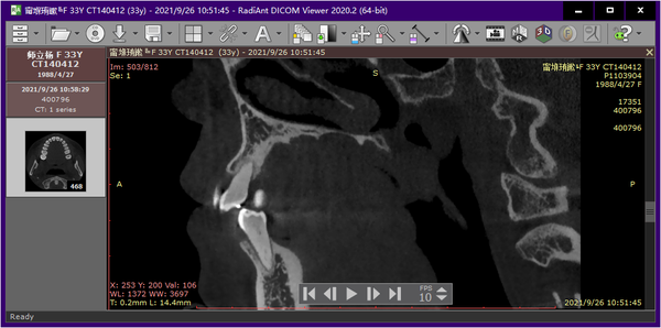 使用NNT Viewer把CBCT进行格式转化（.a111->.dcm） - 知乎