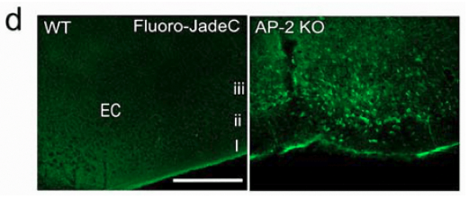 Fluoro-Jade C（FJC）染色试剂盒已发表高品质文章鉴赏 - 知乎