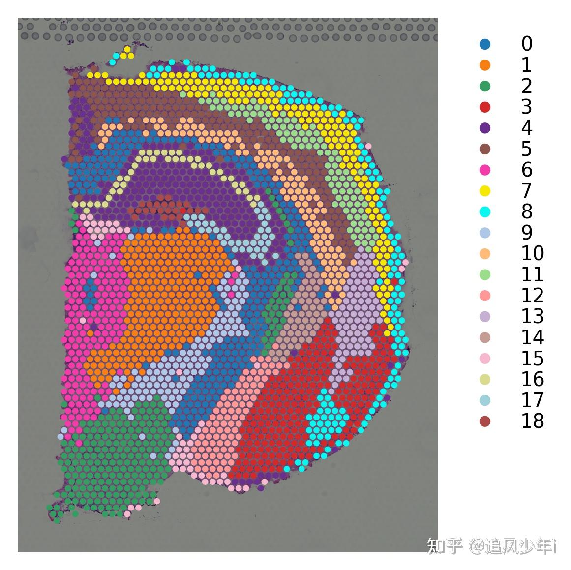10X单细胞空间回顾之stlearn - 知乎