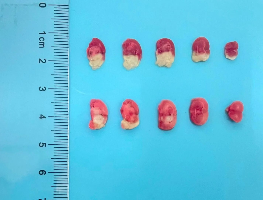 疾病模型 | 脑卒中模型之——MCAO脑缺血动物模型 - 知乎