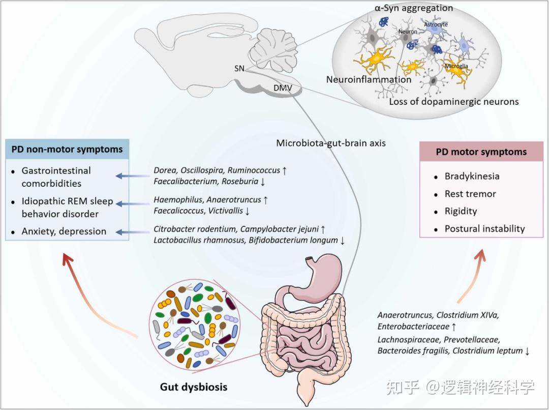 Ageing Res Rev 综述︱肠道微生物组生态紊乱与帕金森病之间的新见解：致病性和临床相关性 - 知乎