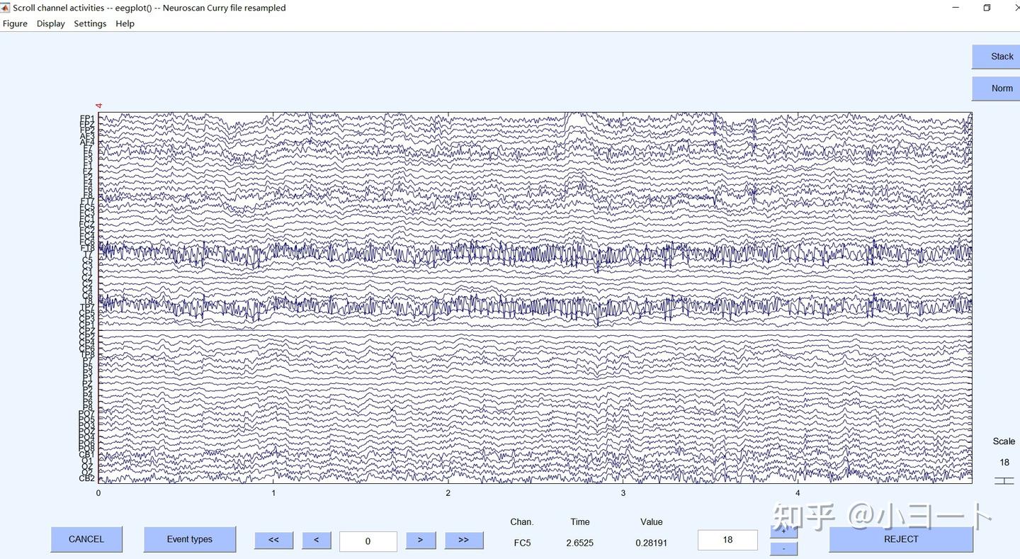 手把手系列教程||使用EEGLAB2023版对脑电数据进行预处理 - 知乎