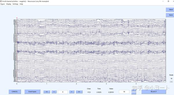手把手系列教程||使用EEGLAB2023版对脑电数据进行预处理 - 知乎