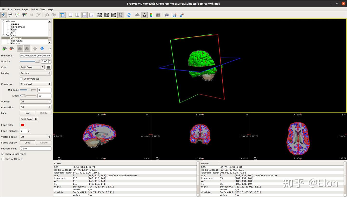Freesurfer在Ubuntu20.04安装教程 - 知乎