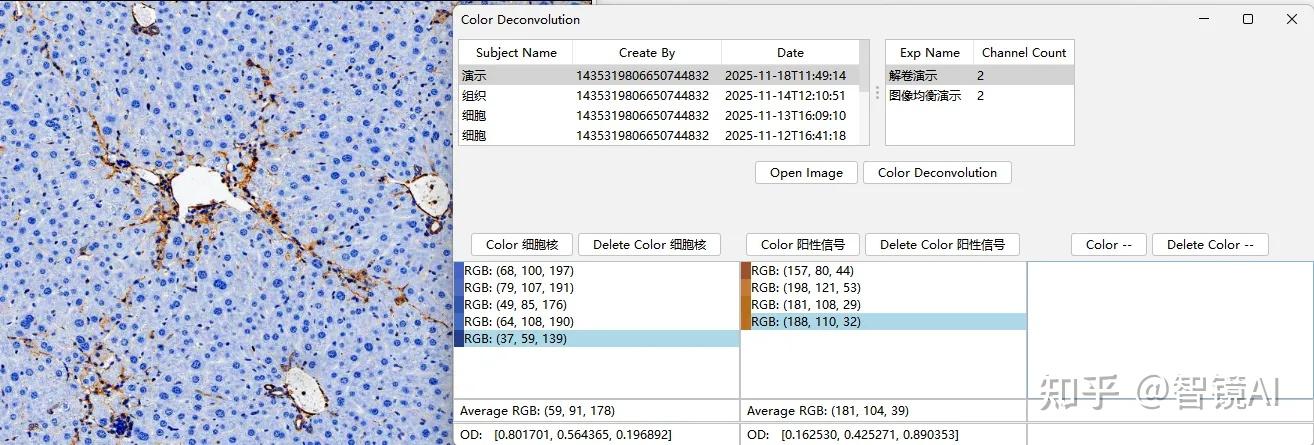 【Color Deconvolution】IHC 颜色解卷通道分离完整教程 - 知乎
