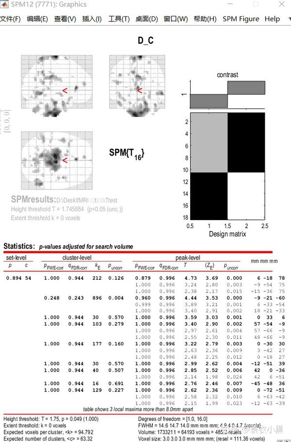 使用spm12对fMRI功能信号进行双样本t检验 - 知乎