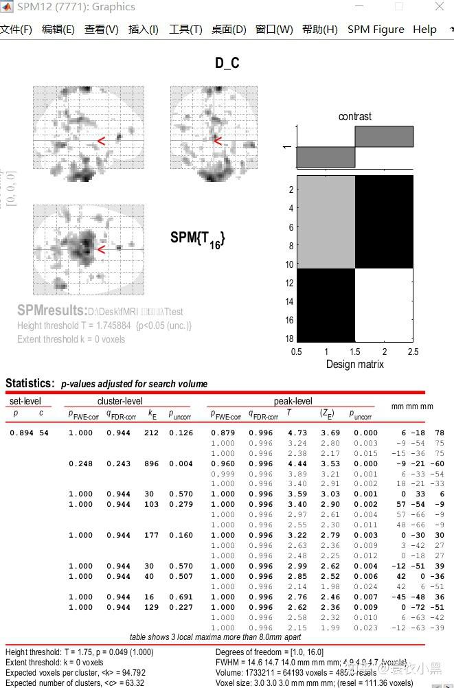使用spm12对fMRI功能信号进行双样本t检验 - 知乎
