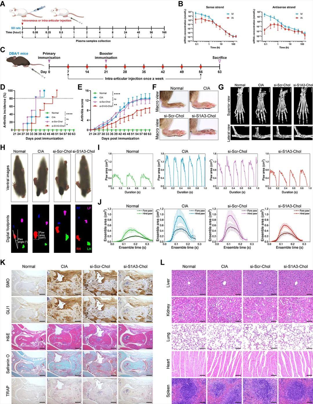 Mol Ther-Nucl Acids︱黄建林/巫林平团队揭示靶向Hedgehog通路化学修饰siRNA有望治疗类风湿关节炎 - 知乎