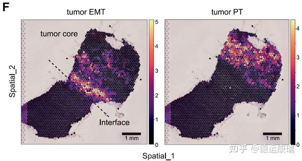 聚焦生信 | Cell2location法联合单细胞转录组进行空间转录组细胞类型映射-附代码 - 知乎