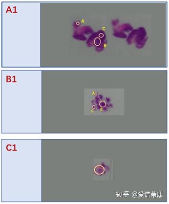 “片”舟已过万重山——“FFomic” · FFPE组织样本切片 蛋白质组学检测技术 - 知乎