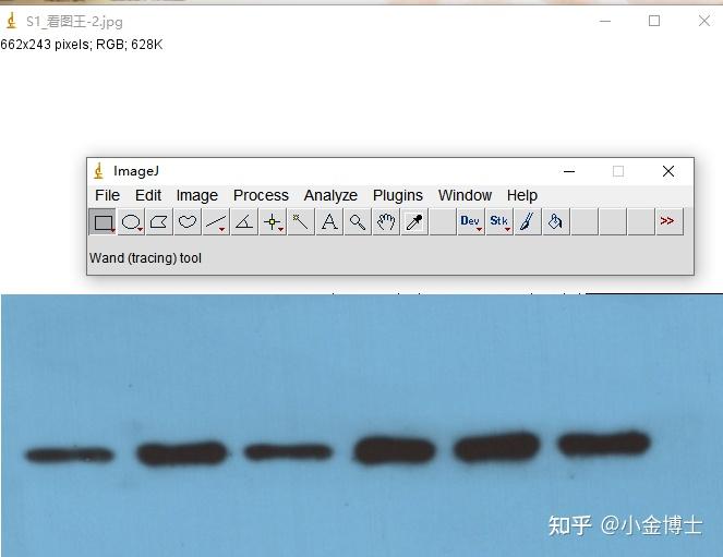干货分享：如何使用ImageJ对WB条带进行灰度值分析 - 知乎