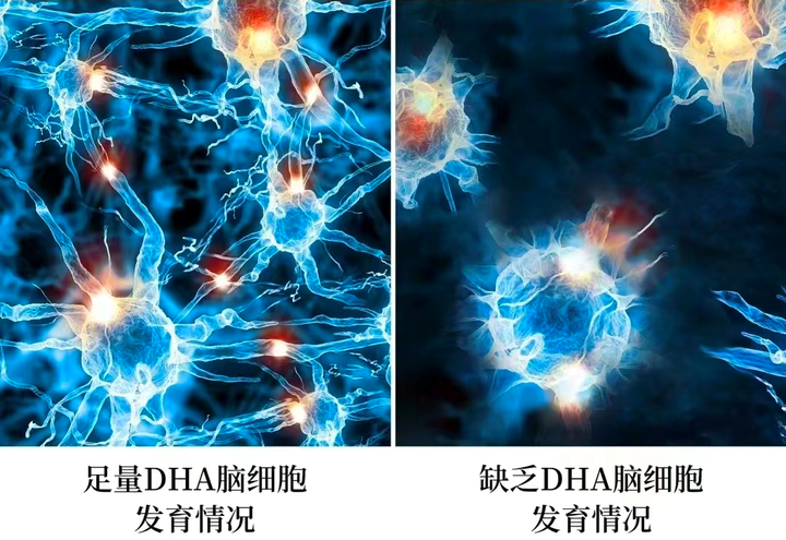 儿童补充DHA，到底有哪些需要注意的？ - 知乎