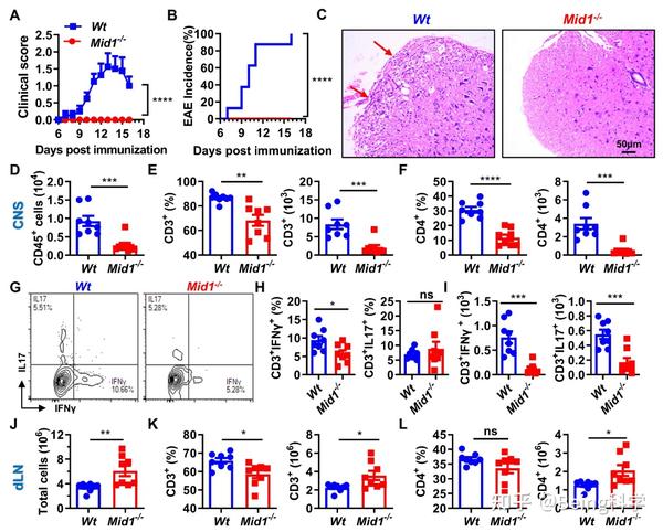 Theranostics︱华中科技大学课题组揭示自身反应性T细胞迁移机制，Mid1是关键调控因子 - 知乎