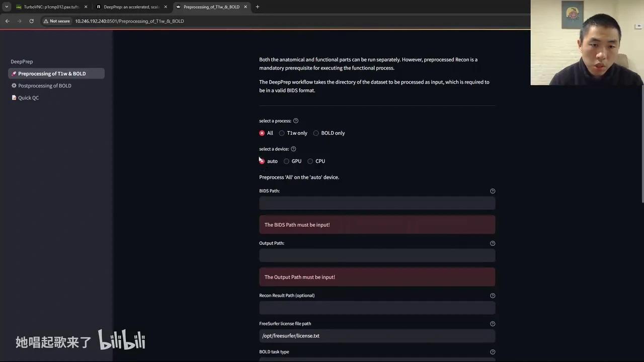 DeepPrep-基于深度学习的fMRI预处理工具 - 知乎