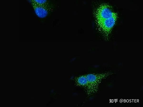 信号通路蛋白的免疫荧光检测 - 知乎