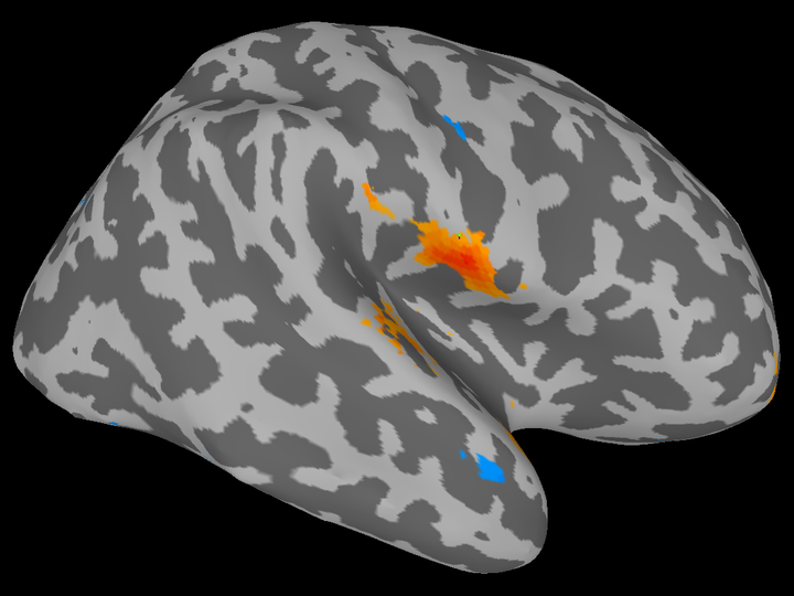 AFNI 将fmri结果投到surface上 - 知乎