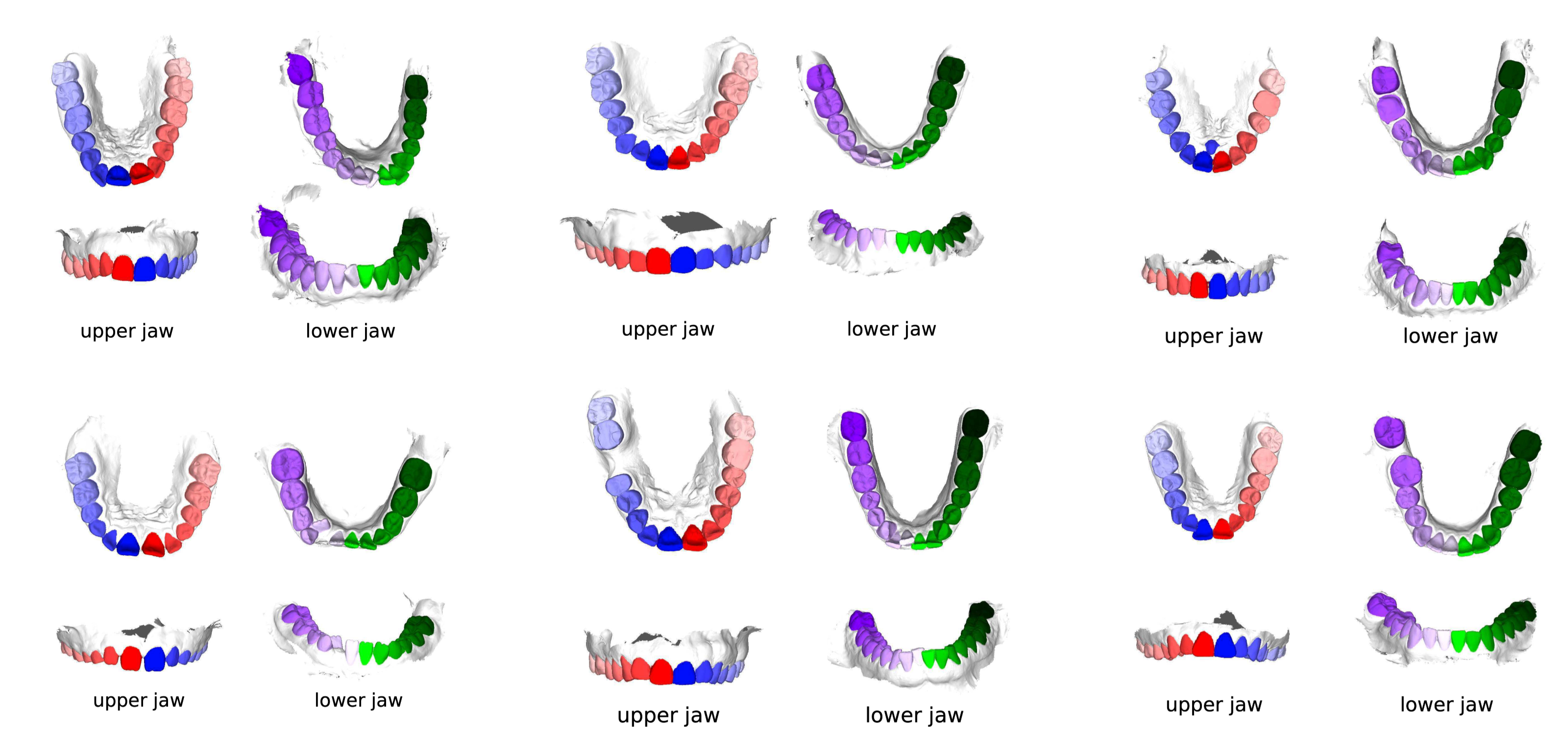 Teeth3DS 数据集介绍 - 知乎
