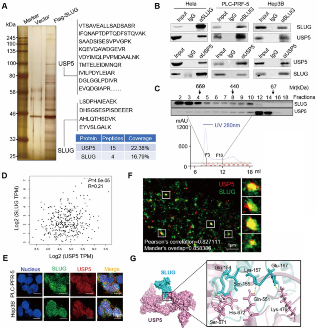 USP5通过稳定肝细胞癌的SLUG促进上皮-间质转化 - 知乎