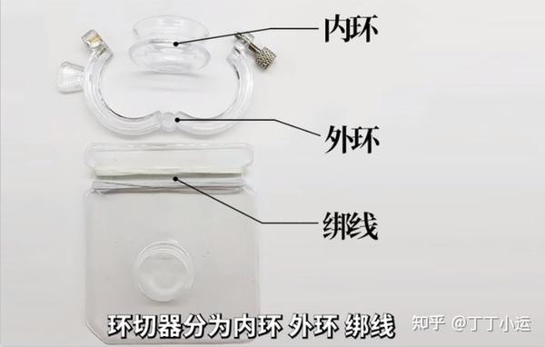 某小伙网购器械自己切包皮，导致皮肤坏死（真实案例） 知乎