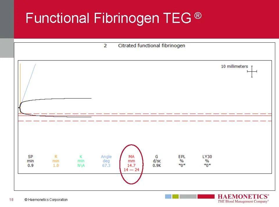 TEG 6s 应用课件分享 - 知乎