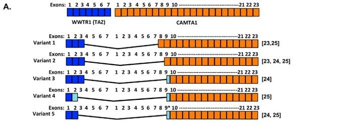 WWTR1—CAMTA1融合对上皮样血管内皮瘤的影响（下） - 知乎