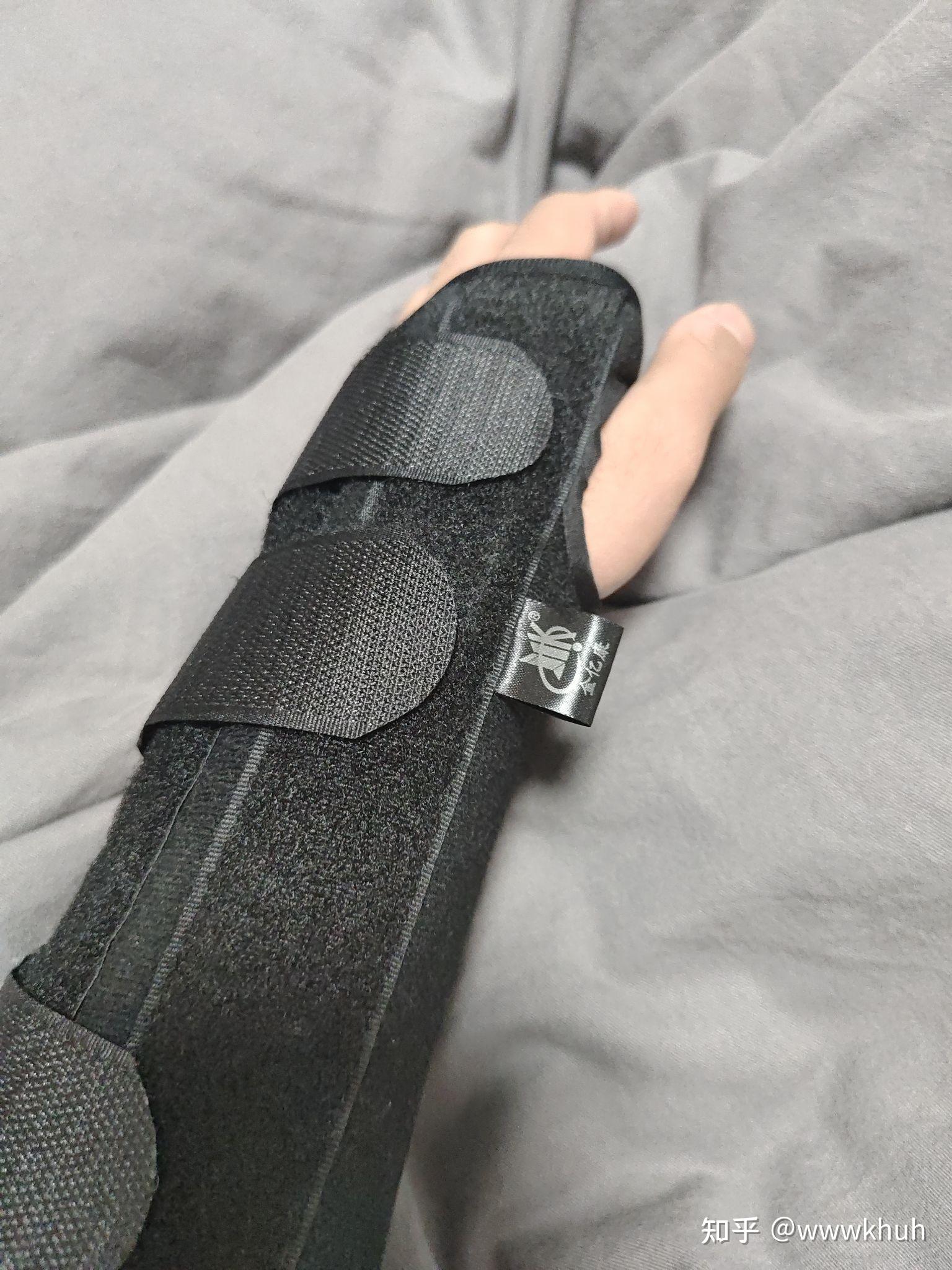 三角纤维软骨（tfcc）损伤，该如何治疗和康复呢？ - 知乎