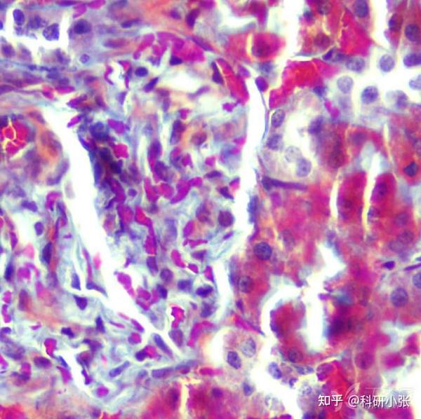 病理实验服务|Masson染色 - 知乎
