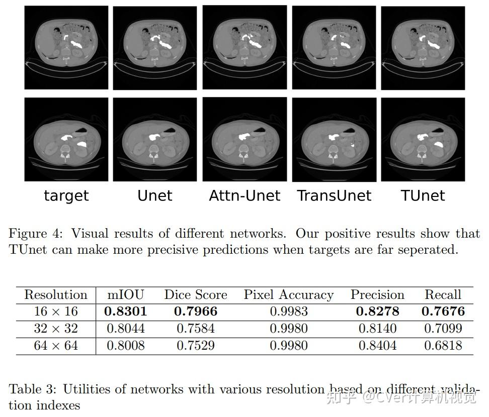 Transformer-Unet：使用 Unet 处理Raw图像(医学图像分割) - 知乎