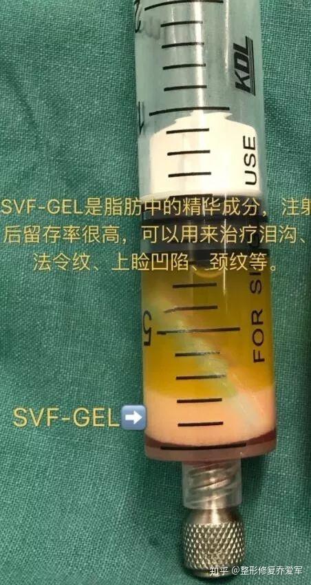 SVF-GEL干细胞脂肪胶：存活率、副作用、安全性、保持时间 - 知乎
