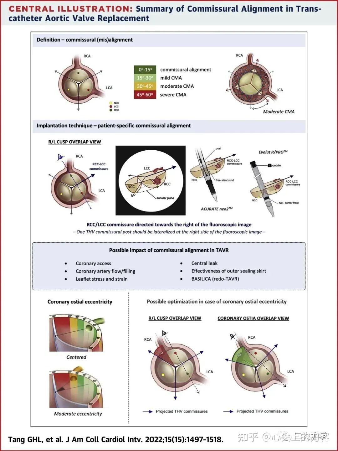连合对齐（Commissural Alignment）：原理、定义、技术和结果（上） - 知乎