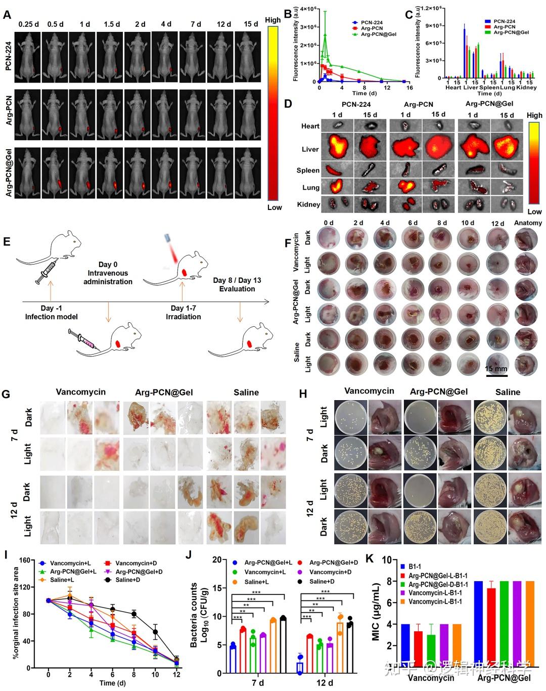 Sci Adv︱华中农业大学谢书宇/陈冬梅团队构建协同光动力和营养免疫的复合纳米系统在耐甲氧西林金黄色葡萄球菌生物被膜的高效精准治疗取得进展 - 知乎