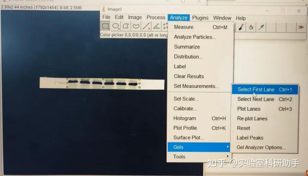 手把手教学——WB条带量化之ImageJ软件分析 - 知乎
