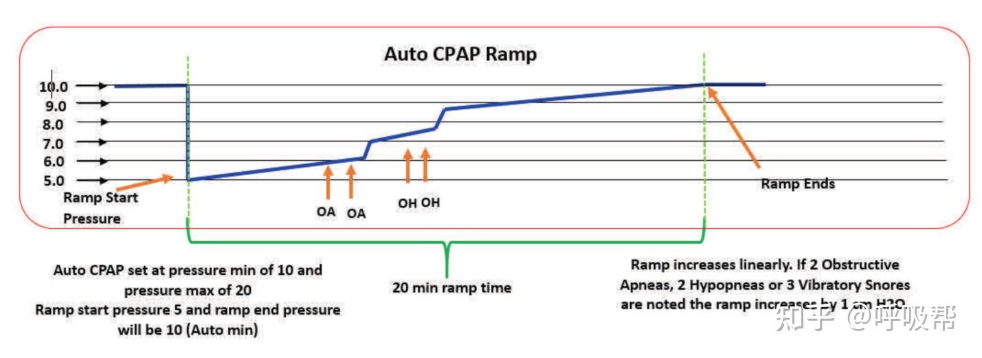 飞利浦伟康（DreamStation Auto）全自动呼吸器的治疗及舒适性参数设定 - 知乎