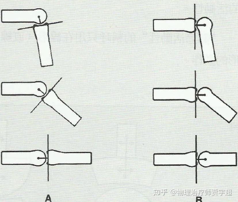 关节松动术三大流派之-Kaltenborn北欧系统 - 知乎