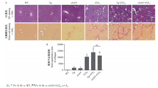 乙肝小鼠模型助力乙肝、肝纤维化和NASH相关研究 - 知乎