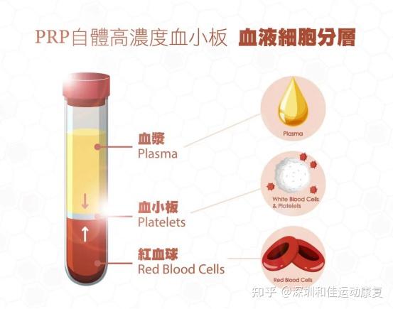 一文带你了解PRP在康复的广泛应用——深圳和佳运动康复 - 知乎