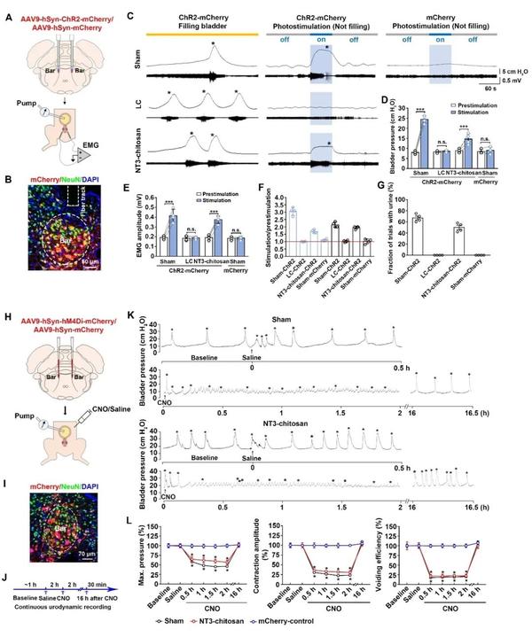 IF=15.304【客户文章】北航李晓光教授团队发文阐明脊髓损伤修复后新生神经元的正确连接控制膀胱功能的新进展 - 知乎