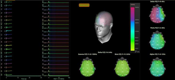 全球领先图表控件LightningChart 全新版本v.10.3.2 已经发布！ - 知乎