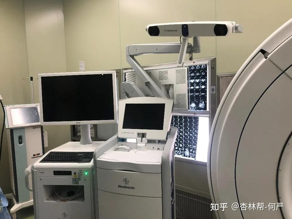 导航让手术更为精准——计算机辅助导航在儿骨科的应用 - 知乎